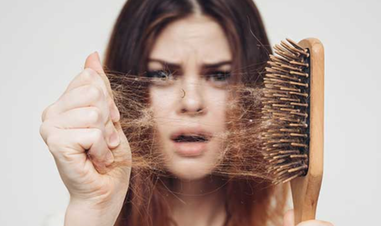 "Pérdida de Cabello: Las 5 Causas Potenciales, Según Expertos Dermatólogos"
